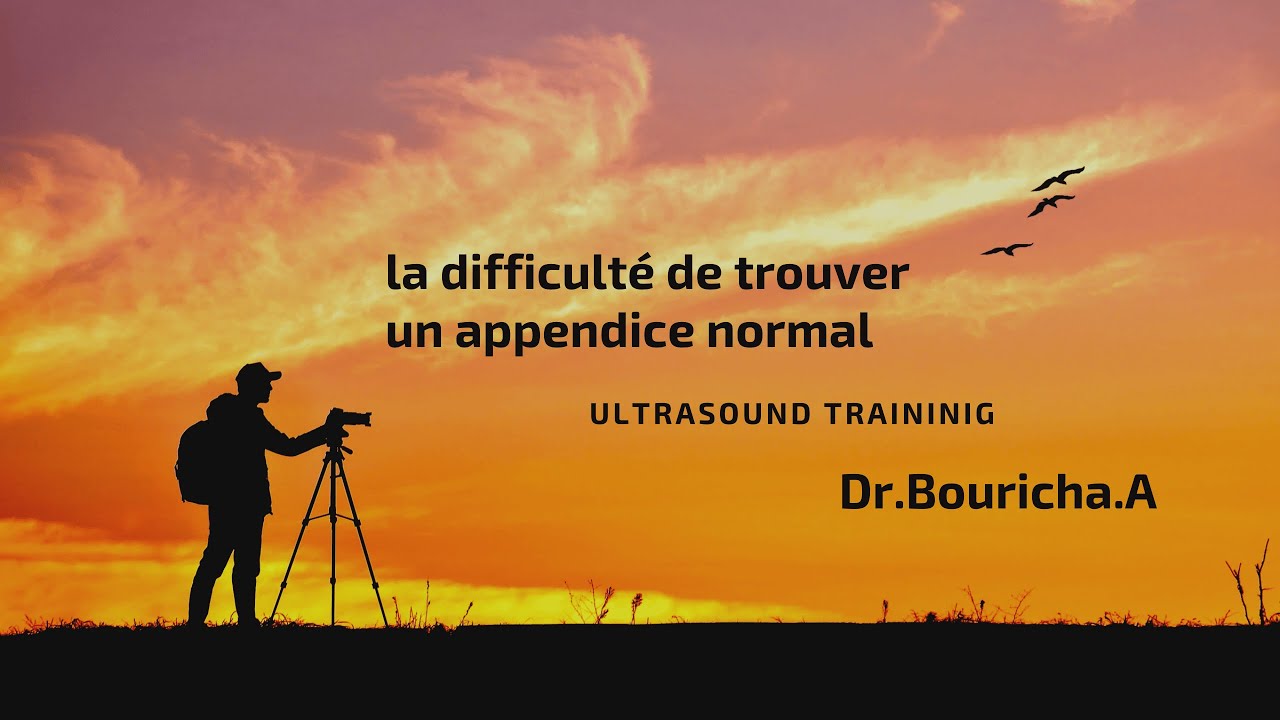 la difficulté de trouver un appendice normal "Challenges in Identifying a Normal Appendix" - YouTube