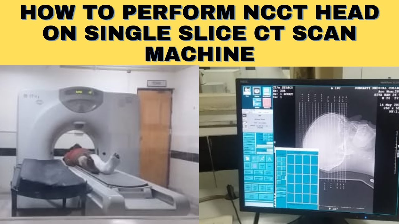 How to Perform NCCT Head scan on Single Slice CT scan machine l ...