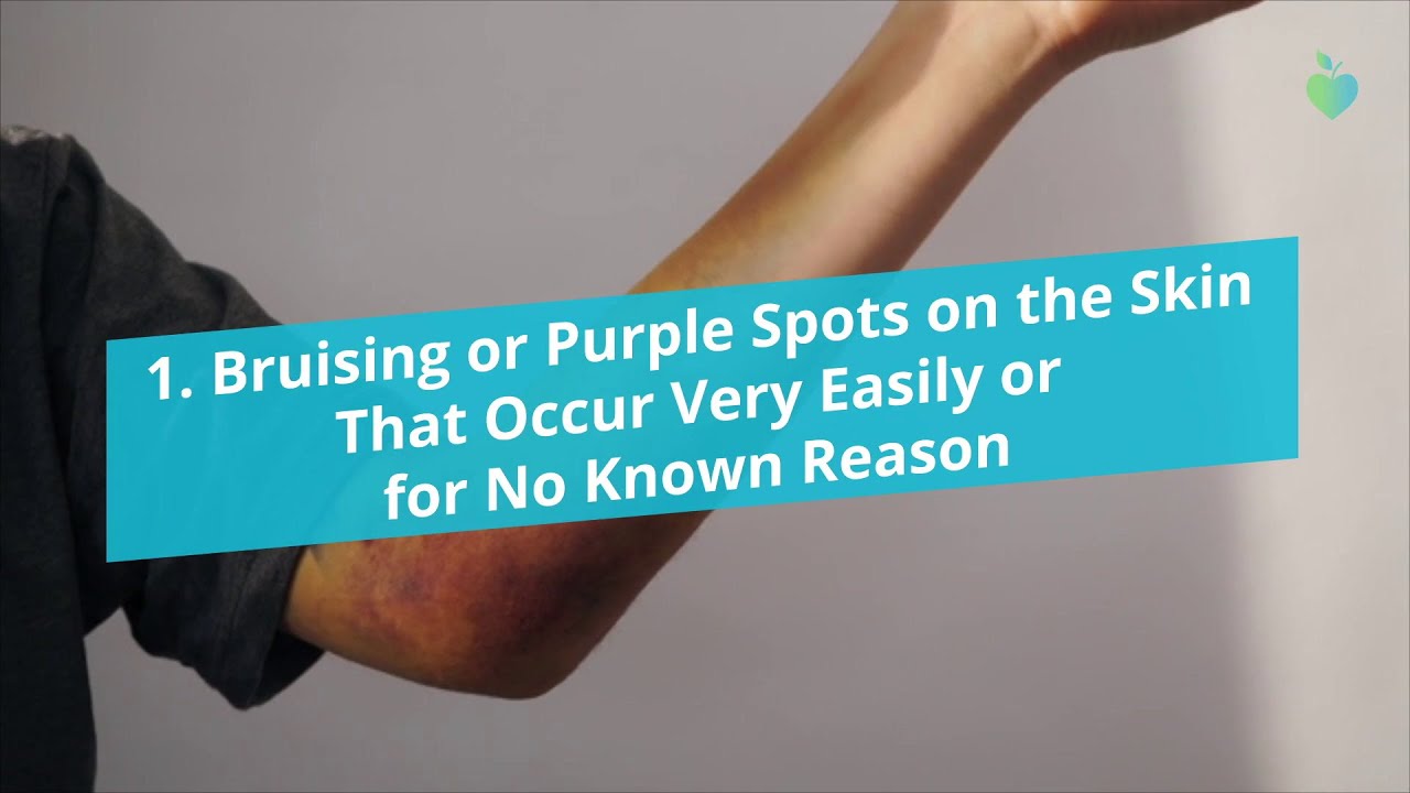 7 Signs and Symptoms of Immune Thrombocytopenia (ITP) - YouTube