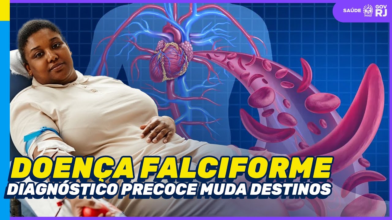 Você conhece a doença falciforme? Diagnóstico precoce faz toda ...