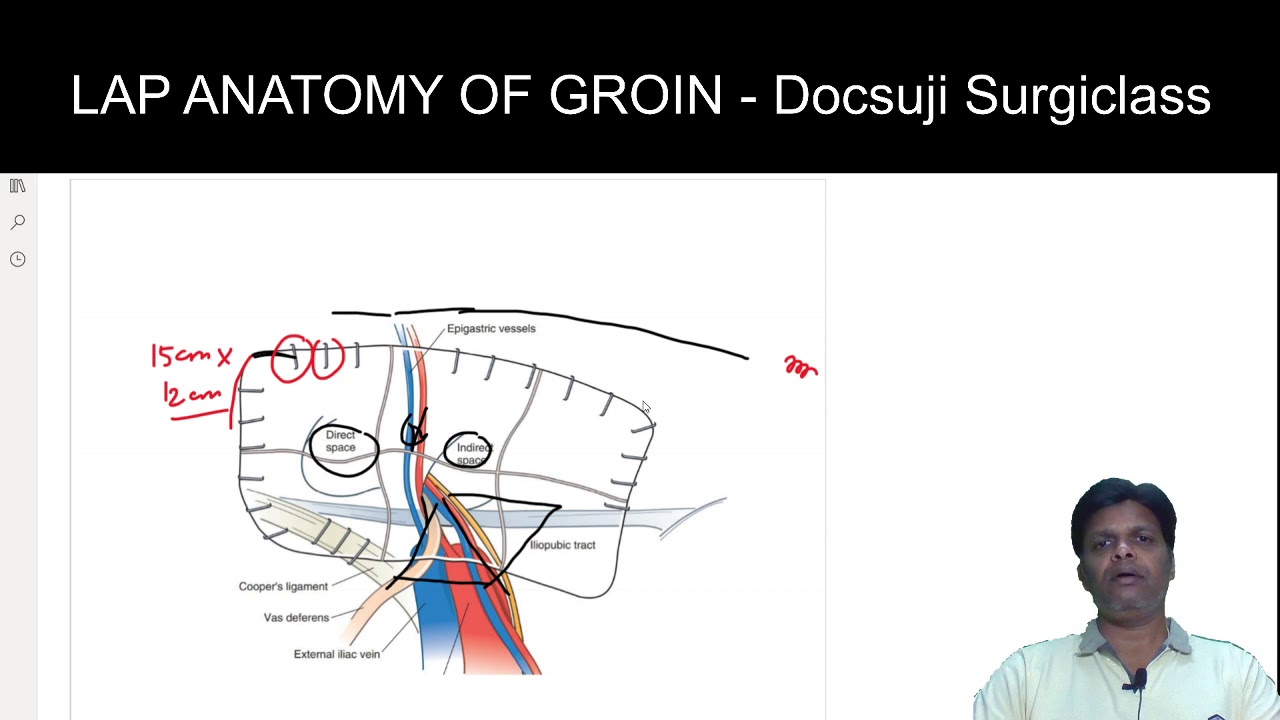 LAPAROSCOPIC ANATOMY OF GROIN - YouTube