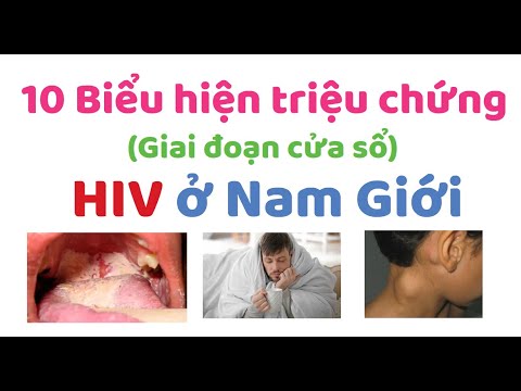 10 Biểu hiện triệu chứng HIV ở Nam Giới (Giai đoạn cửa sổ) - YouTube