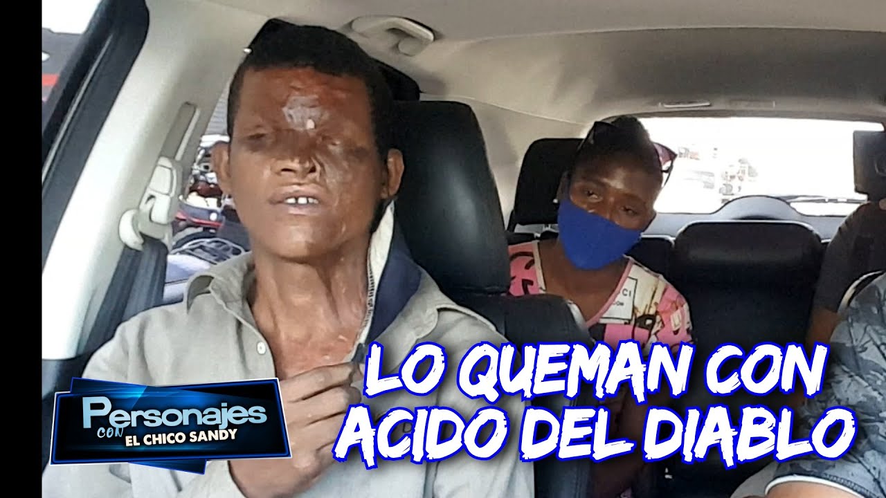 INCREIBLE LO QUEMAN CON ACIDO DEL DIABLO. PERSONAJES CON EL CHICO SANDY ...