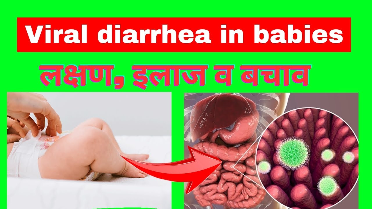 बच्चो में वायरल डायरिया के लक्षण व इलाज | how to stop diarrhea | viral ...
