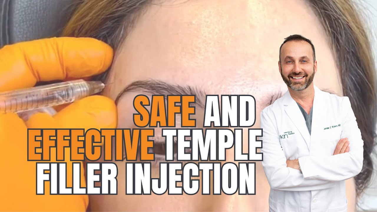 Safe temple filler injection #templefiller #dermalfillers #dermalfiller ...