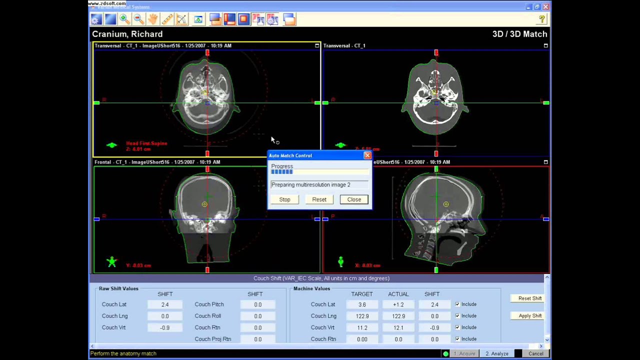 OBI CBCT Process - YouTube