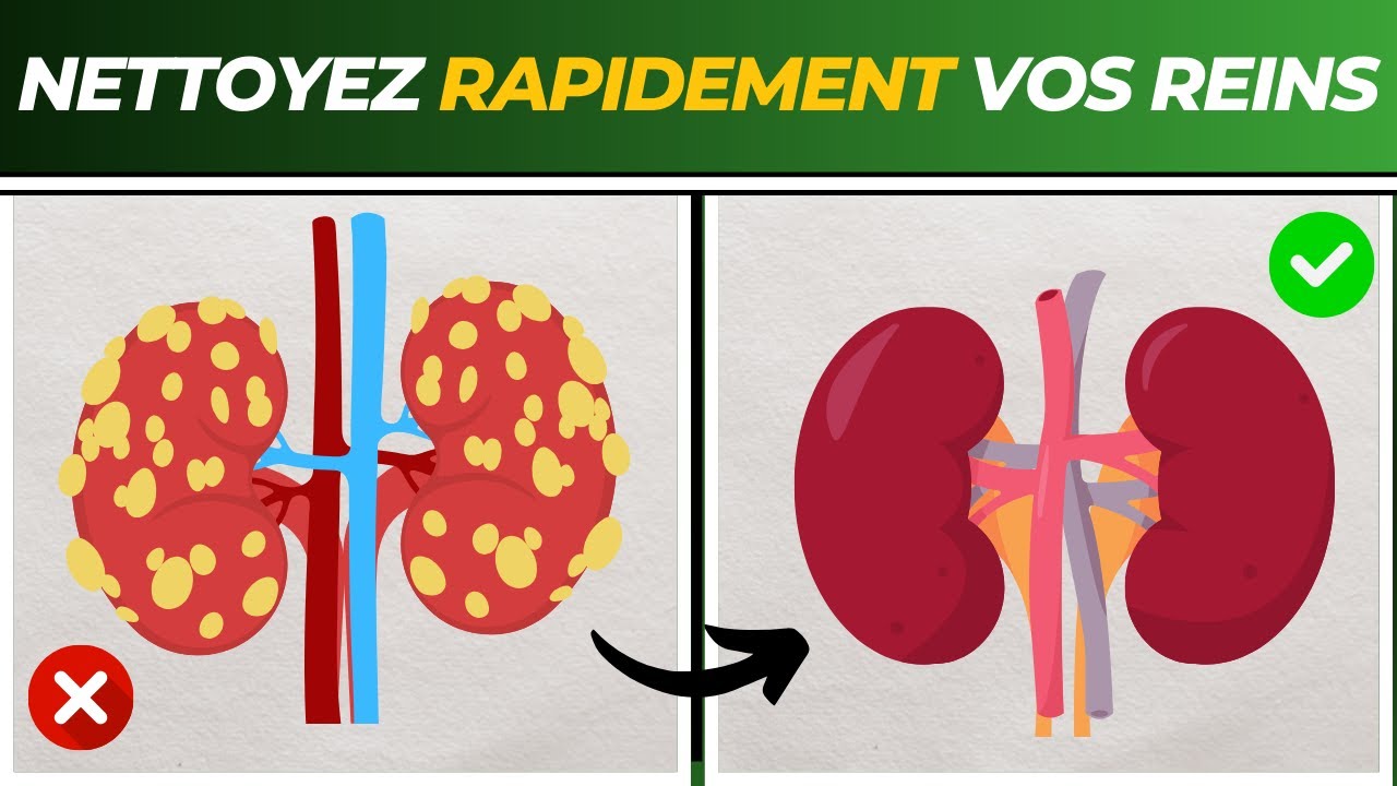 Voici comment Nettoyer vos Reins– Guide pour des Reins en Bonne santé ...