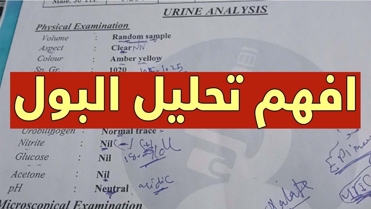 كيف تقرأ تحليل البول وتعرف العلاج المناسب للاملاح Youtube