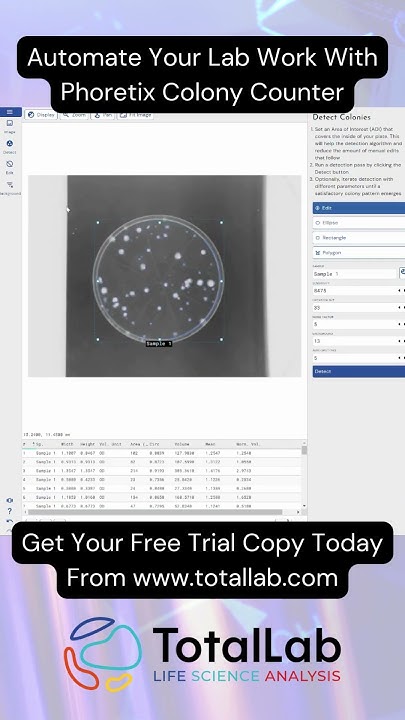 Automatic Colony Counting with Phoretix Colony Counter 🧫 | Accurate Bacterial Analysis! - YouTube
