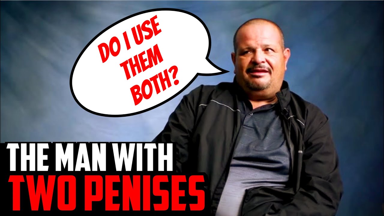 The Man Born With 2 Penises! How Did This Happen?? - YouTube