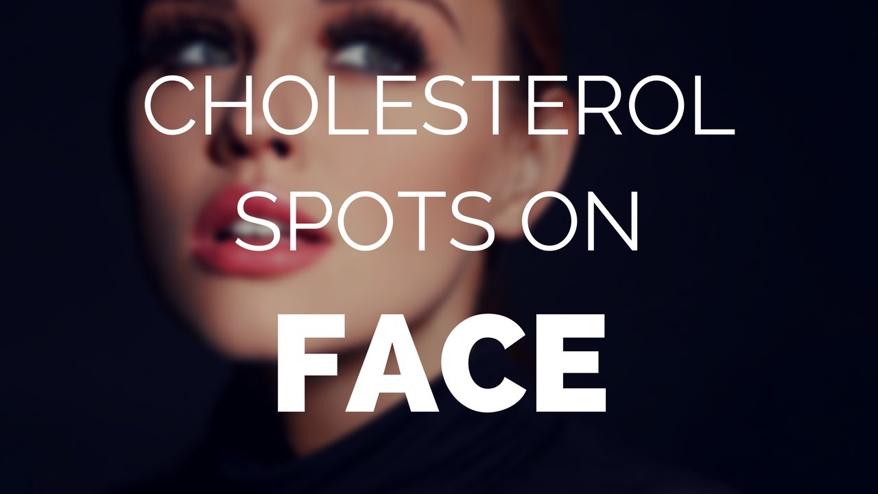 cholesterol spots on face and how to treat them. - YouTube