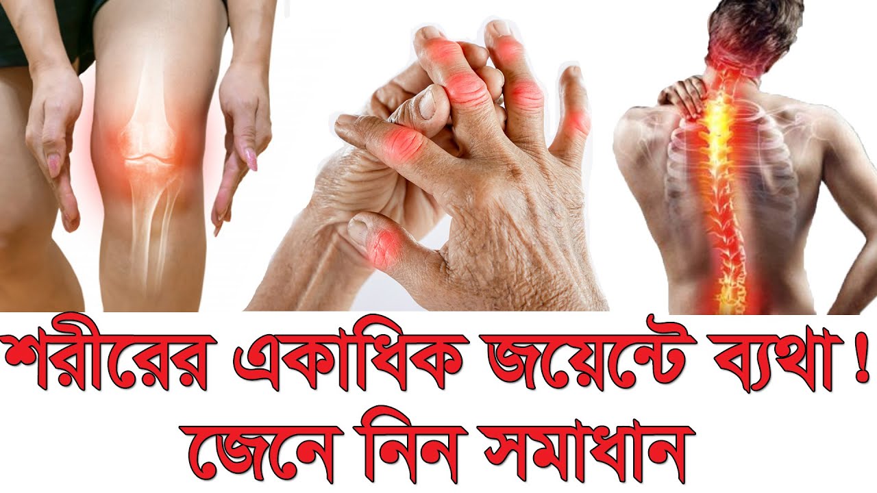 শরীরে একাধিক জায়গায় ব্যথা হলে করনীয়, Multiple Joint Pain - YouTube