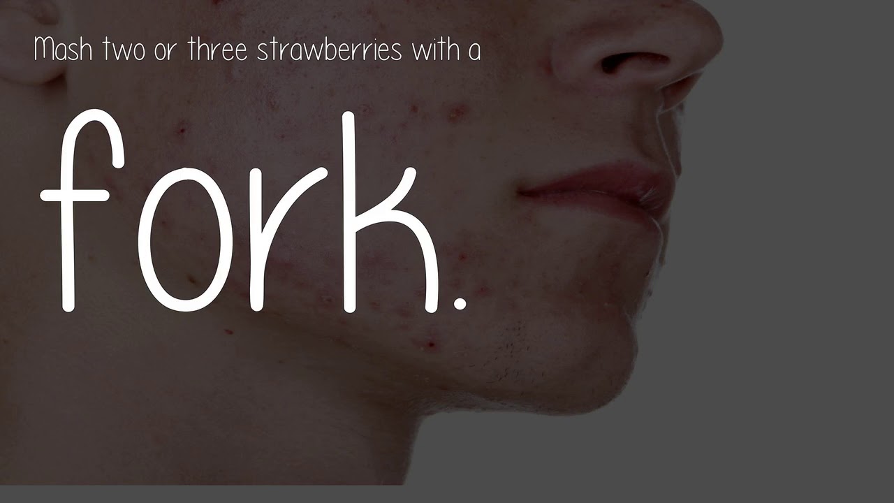 How Do I Lighten Up An Acne Bruise? - YouTube