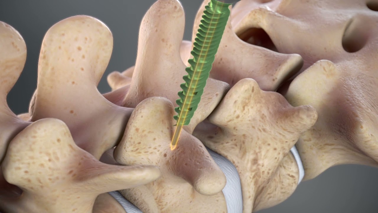 Viper Prime - YouTube