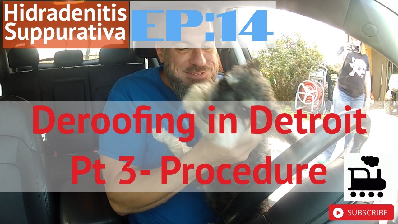 Hidradenitis Suppurativa Ep14 - Deroofing in Detroit part 3 - YouTube