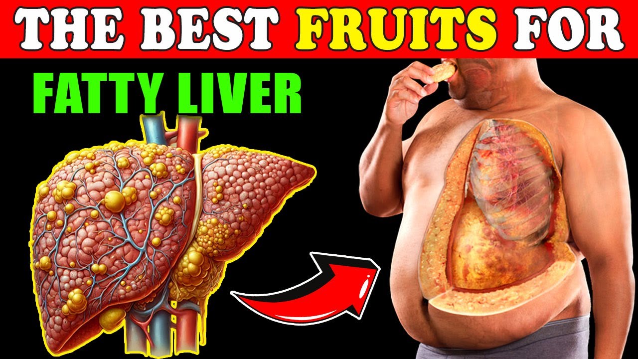 What Are The BEST Fruits For FATTY LIVER? (PROVEN) | Golden Nutrition ...