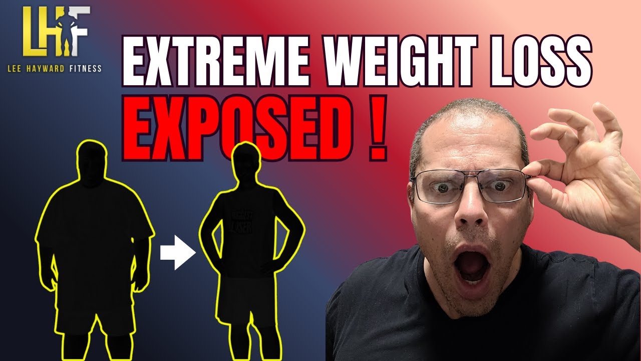 Biggest Loser vs. Real Life: Extreme Weight Loss Results - YouTube