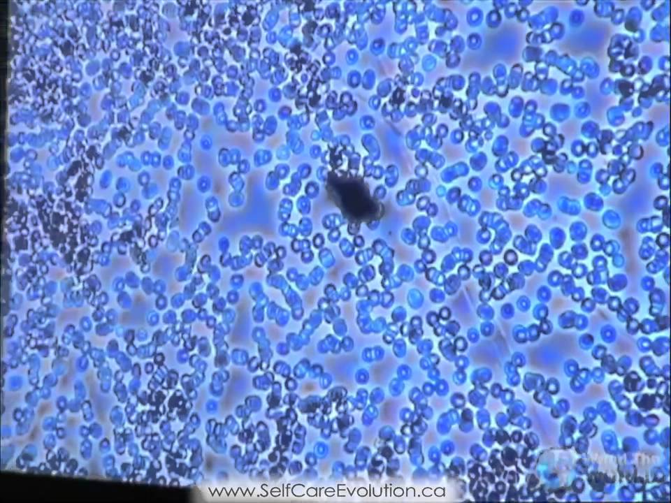 Live Blood Analysis - Electrical Charge - YouTube