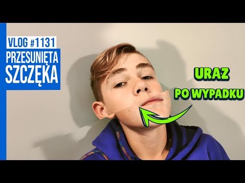 PRZESUNIĘTA SZCZĘKA - URAZ PO WYPADKU / VLOG #1131