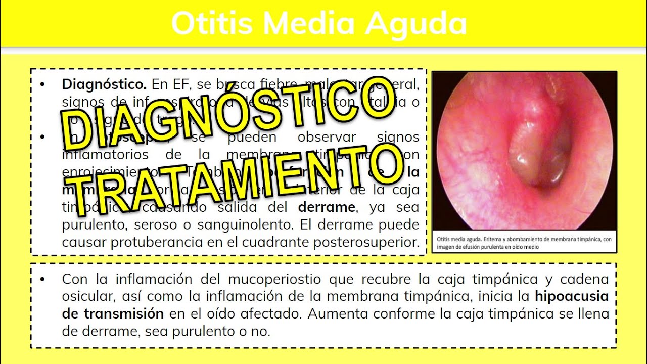 Otitis Media En Adultos: Causas Y Síntomas – IEVUO