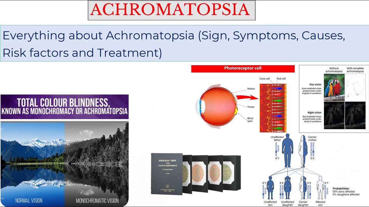 Achromatopsia_ Causes, Risk factors, Etiology, Sign, Symptoms and ...