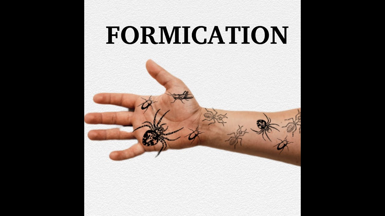 formication - YouTube