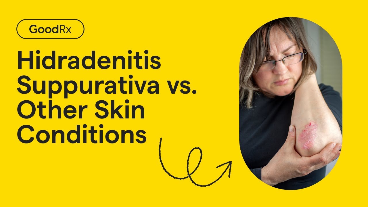 Hidradenitis Suppurativa vs. Other Skin Conditions: How to Tell the ...