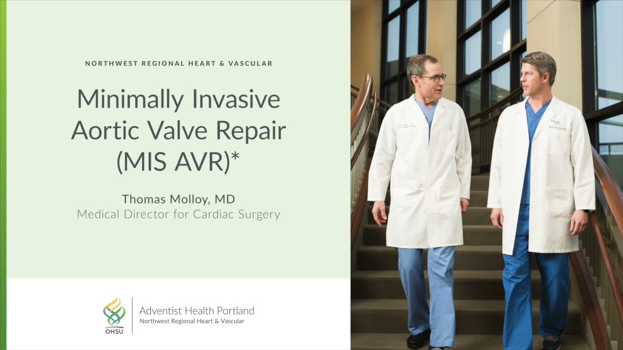 Minimally Invasive Aortic Valve Surgery - Thomas A. Molloy, MD - YouTube