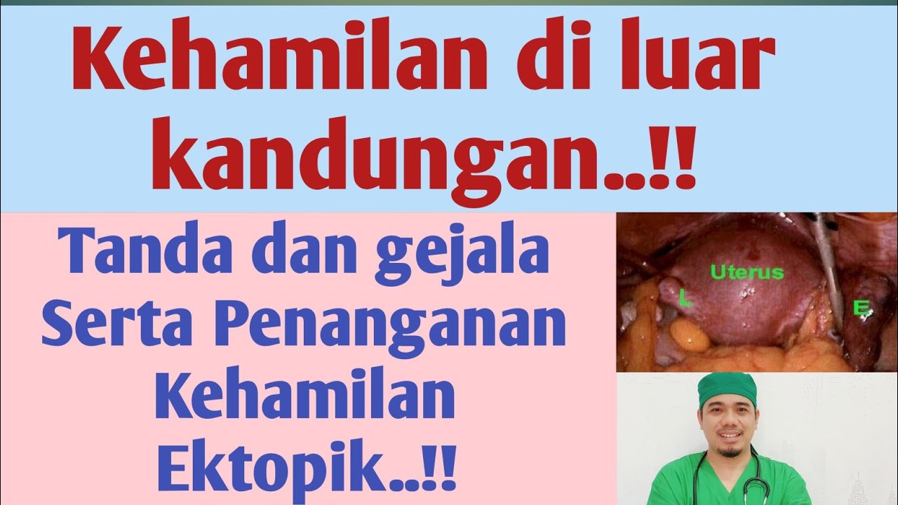 Kehamilan Ektopik (Kehamilan di luar Kandungan)/ Penyebab dan ...