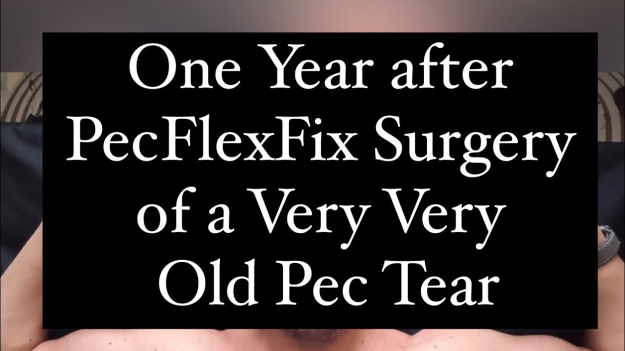 Pec Major Tear Surgery-NO TEAR IS TOO OLD #MoraMD #pecmajortendon - YouTube