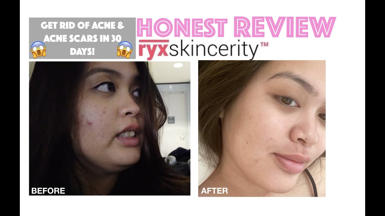 Quarantine Glow Up: HONEST REVIEW on RYX Skincerity Starter Kit - YouTube