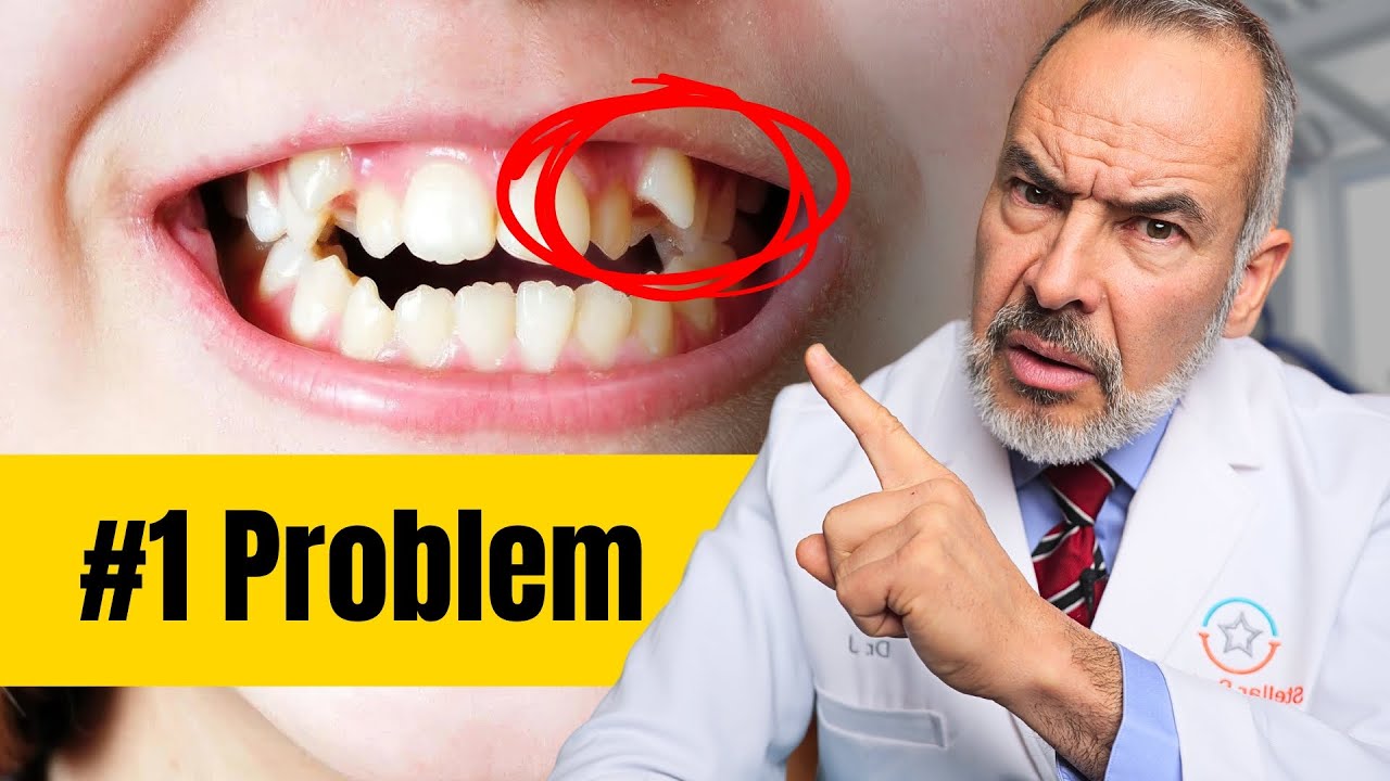 Dentists REGRET Not Warning Parents About These Hidden Teeth Issues ...