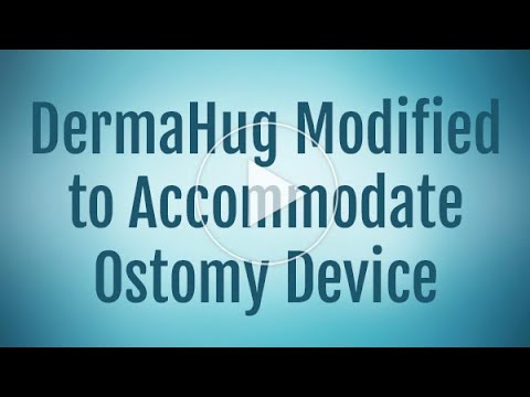 3 DermaHug modified to accommodate Ostomy device - YouTube