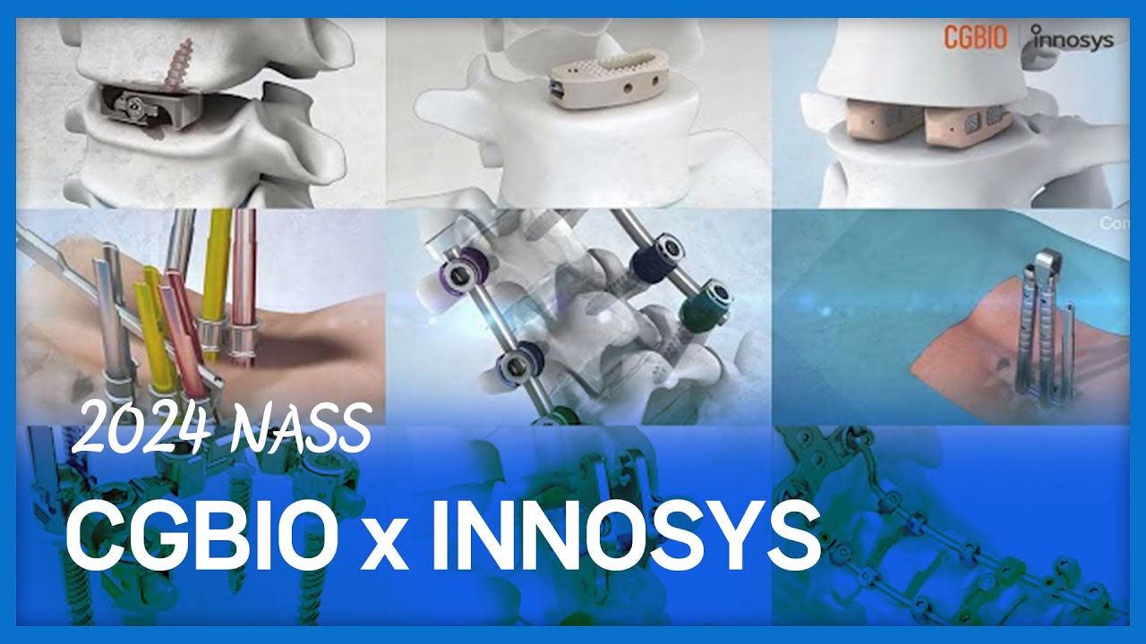 [Bone&Spine] 시지바이오 & 이노시스 2024 프로모션 비디오 CGBIO & INNOSYS PRODUCT PV 2024 - YouTube