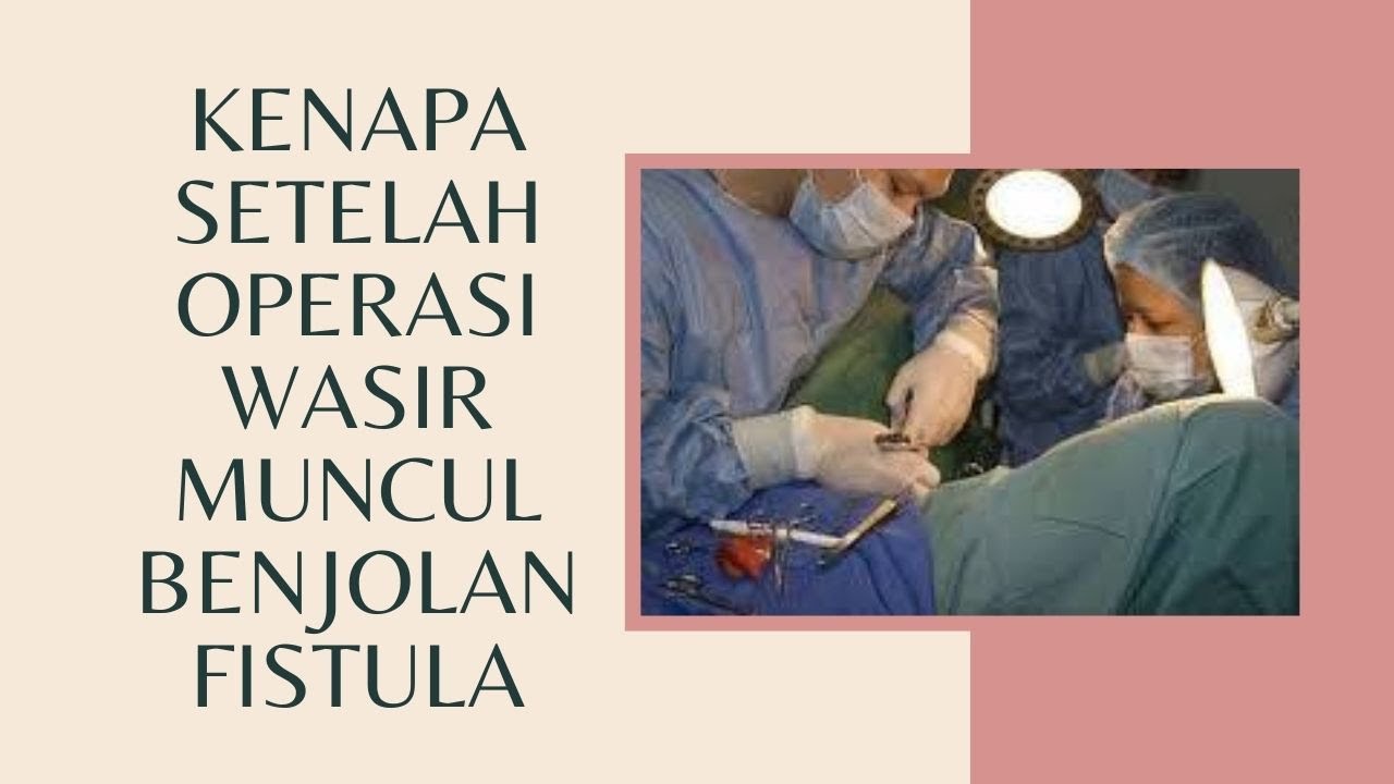 Kenapa Setelah Operasi Wasir Muncul Benjolan Fistula - YouTube