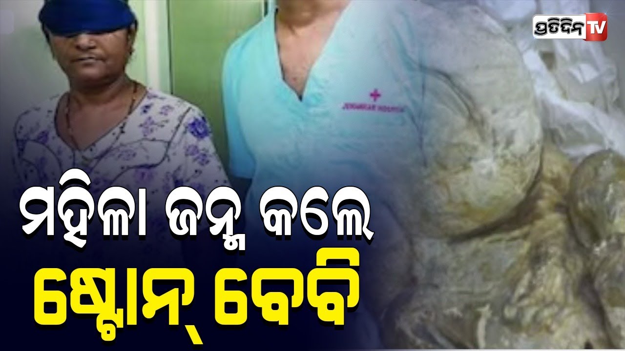 ମହିଳାଙ୍କ ପେଟରୁ ବାହାରିଲା ପଥର ଛୁଆ ! | mother gives birth to stone baby ...