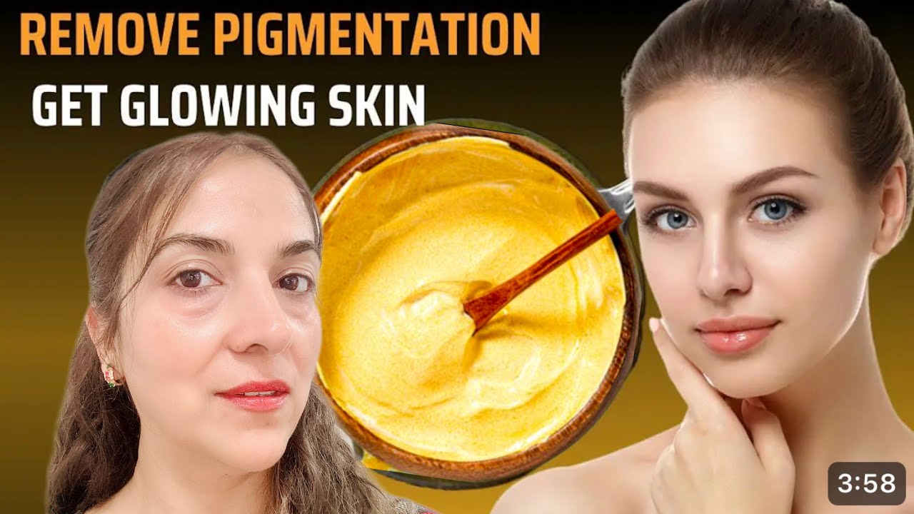 Best Home Remedy For Hyperpigmentation / Darkspots|| How To Remove ...