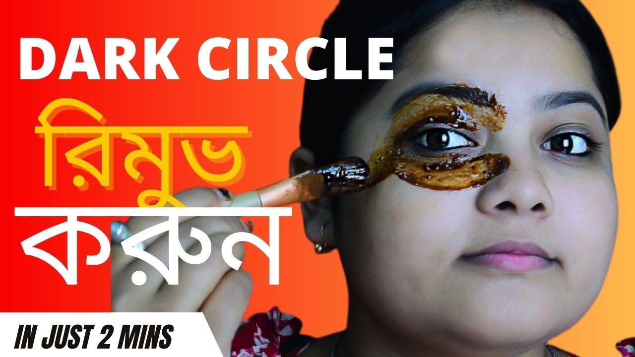 How to remove Dark Circle || Dark Cirle রিমুভ করুন মাত্র ২ মিনিটে ...