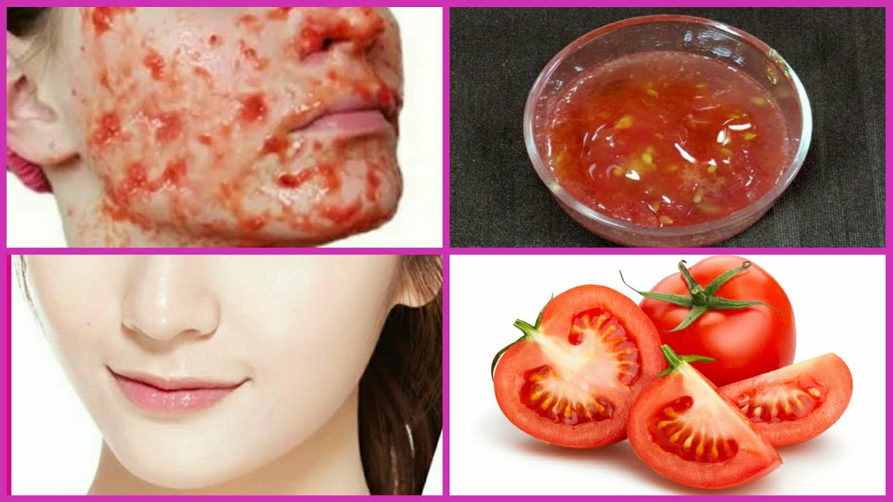 Tomato Facial At Home For Glowing, Spotless & Younger Looking Skin ...