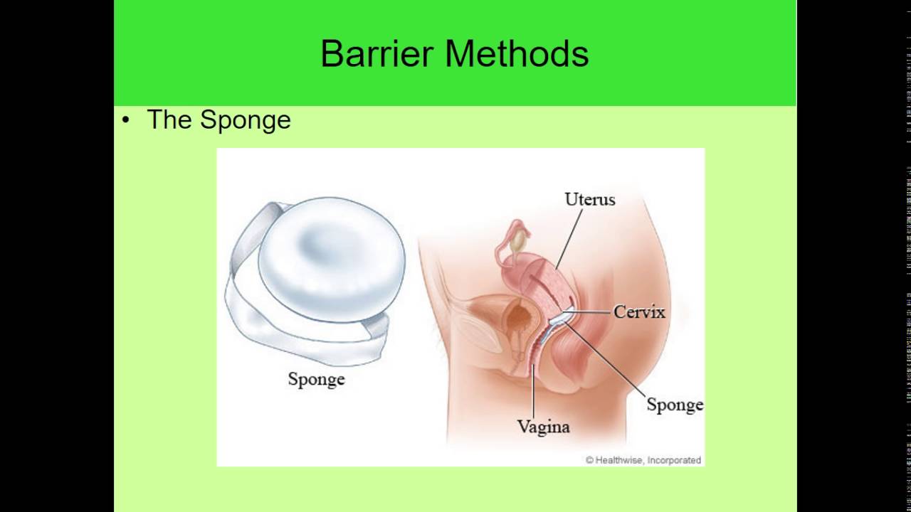 Human Sexuality Ch 5 Barrier Birth Control Methods YouTube human-sexuality-ch-5-barrier-birth-control-methods-youtube