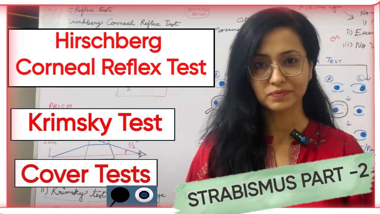 Strabismus Part 2 | Hirschberg Corneal Reflex Test | Krimsky Test ...