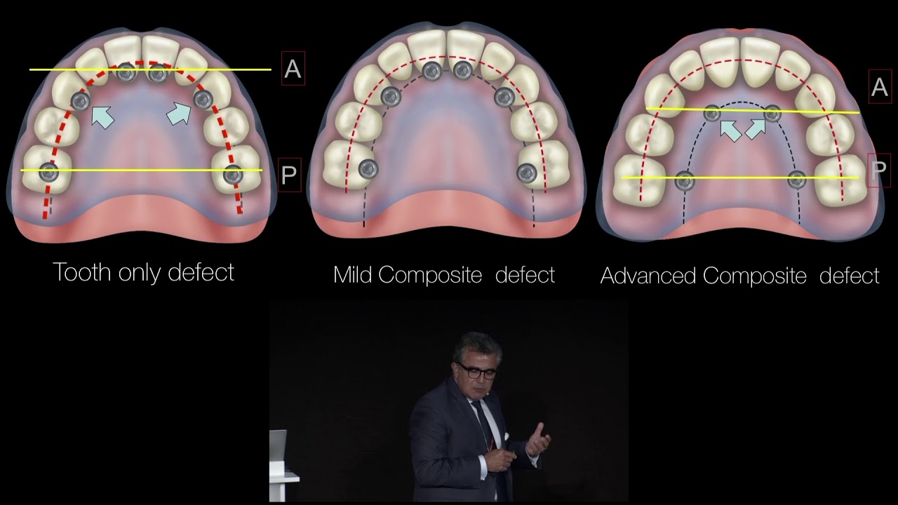 Corporate Forum EAO 2019: Edmond Bedrossian - YouTube