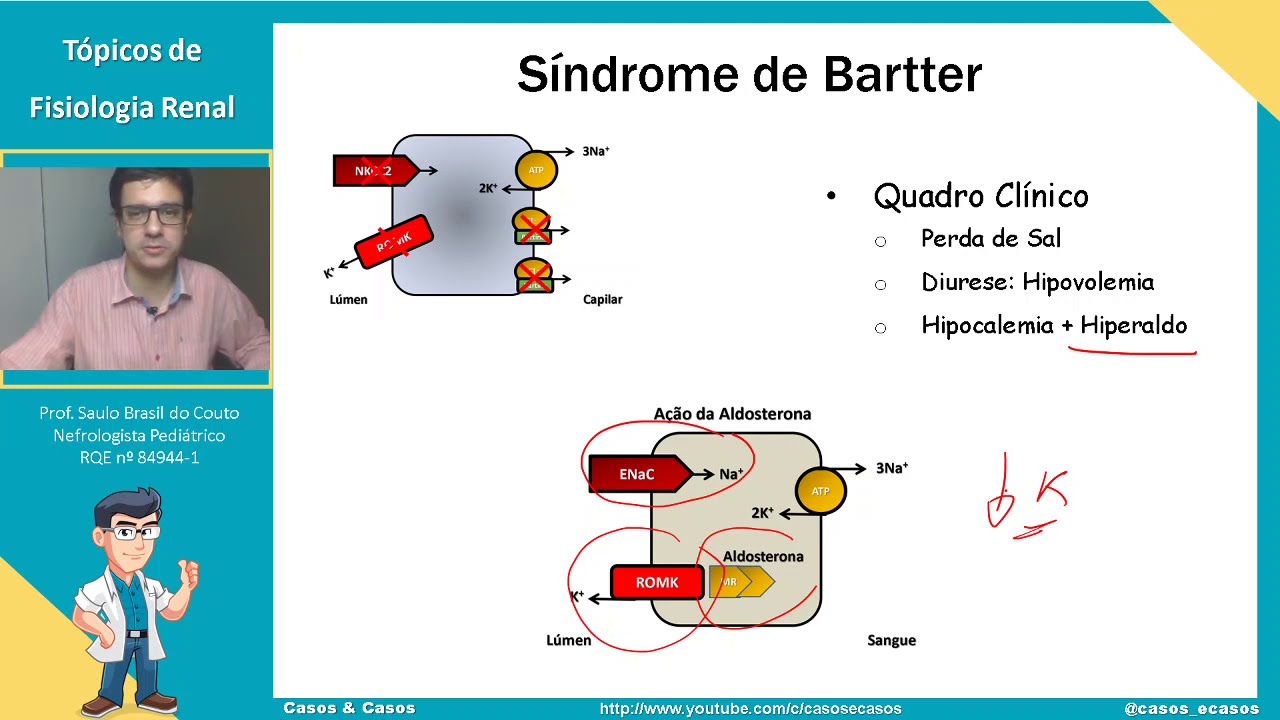 Síndrome de Bartter: Entendendo a Fisiologia Renal - YouTube
