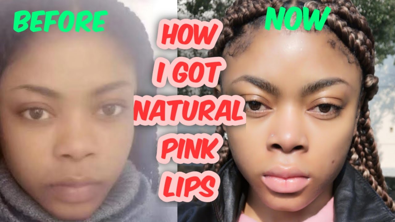 How to | Have Permanent Natural Pink Lips in 3days😍 | with pictures ...