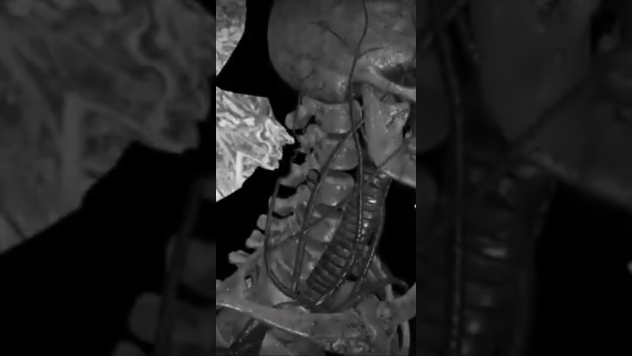 Neck shot sniper elite 4 #ps5 #gaming #ps4 #kill #sniperelite4 #sniper ...