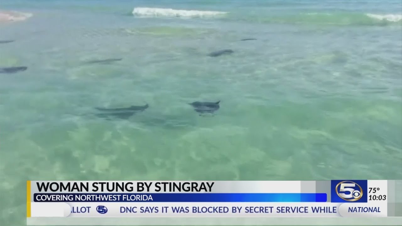 Woman stung by Stingray at Navarre Beach - YouTube