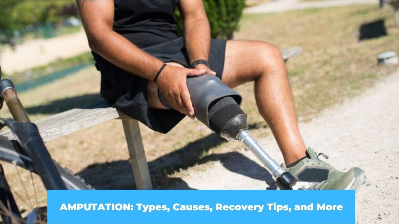 AMPUTATION: Types, Causes, Recovery Tips, and More - YouTube