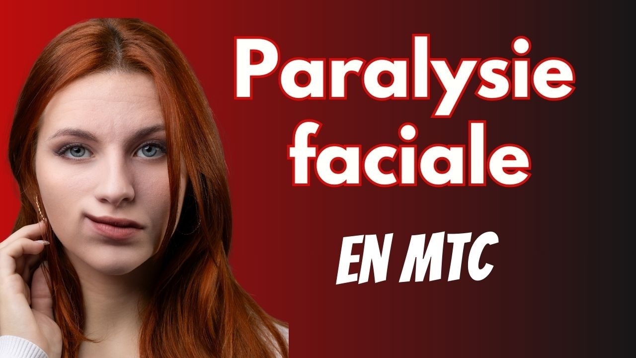L’ acupuncture pour le traitement de la paralysie de Bell / paralysie ...