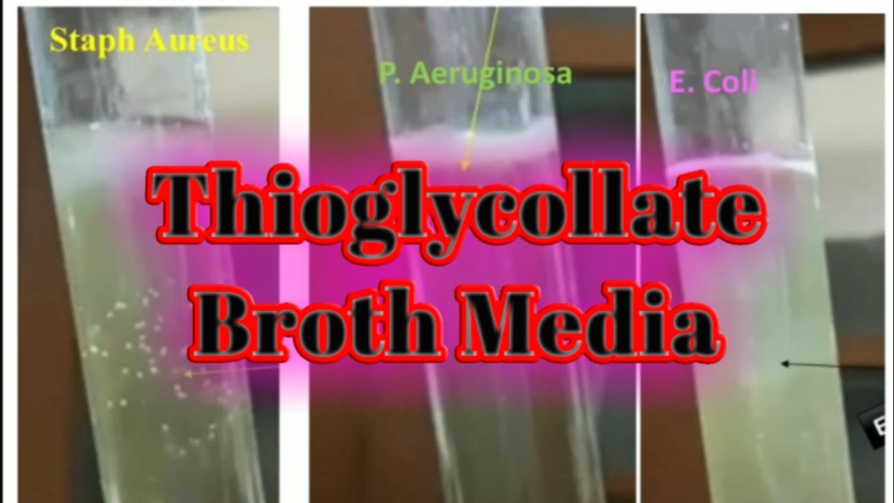 Thioglycollate broth: culture media lecture 36 - YouTube