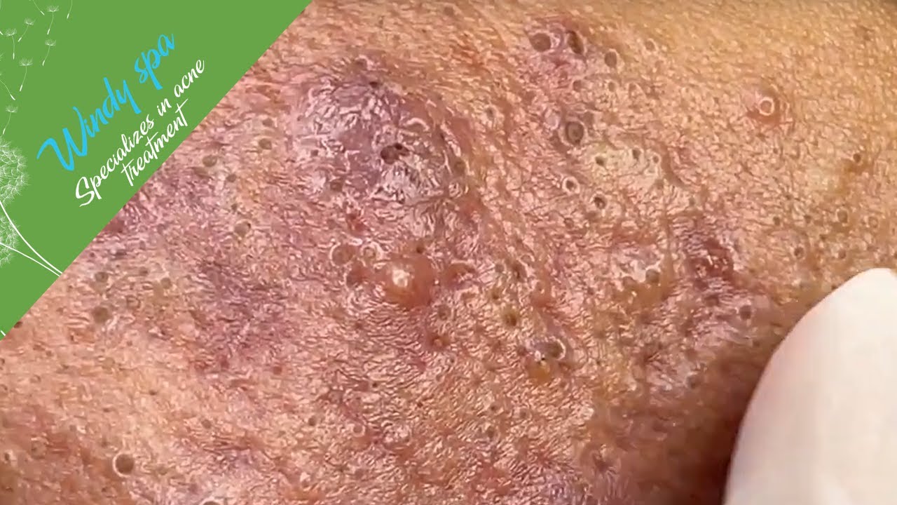 Make Your Day Relaxing with Windy Spa 6#169 - YouTube